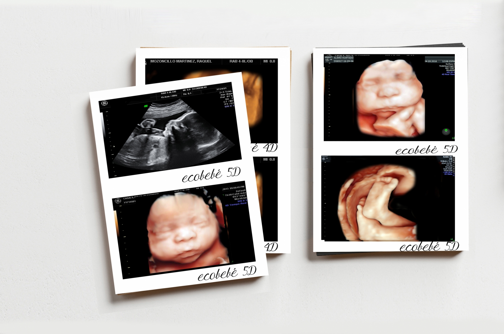 SESIÓN BASIC 5D - Ecobebé 5D - Ecografía 5D Alcalá de Henares